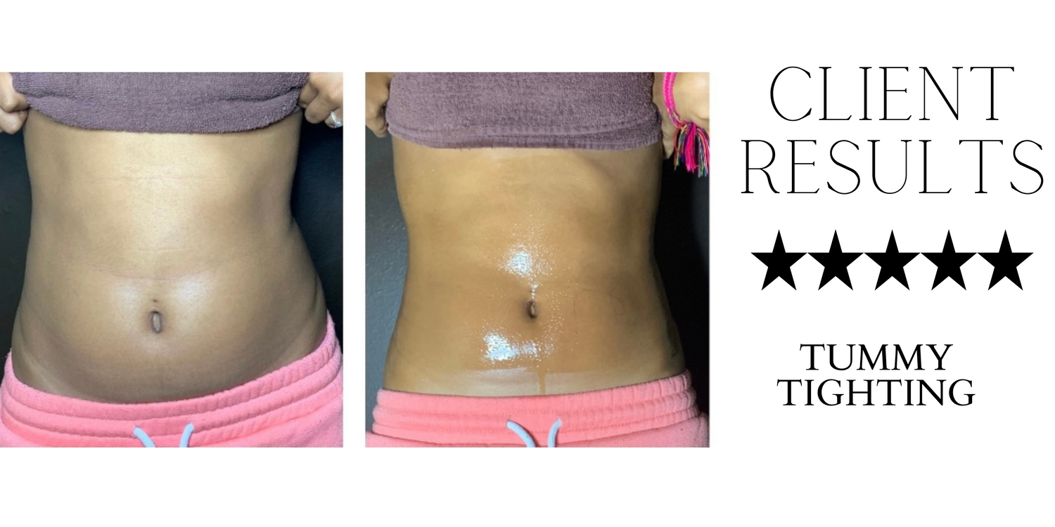 Body Sculpting – Nalu Skin & Body