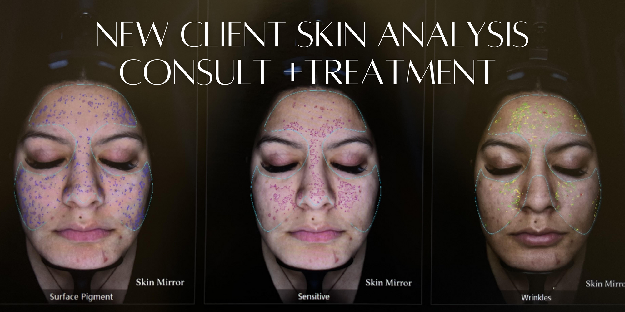 Skin Analysis Scan – Nalu Skin & Body